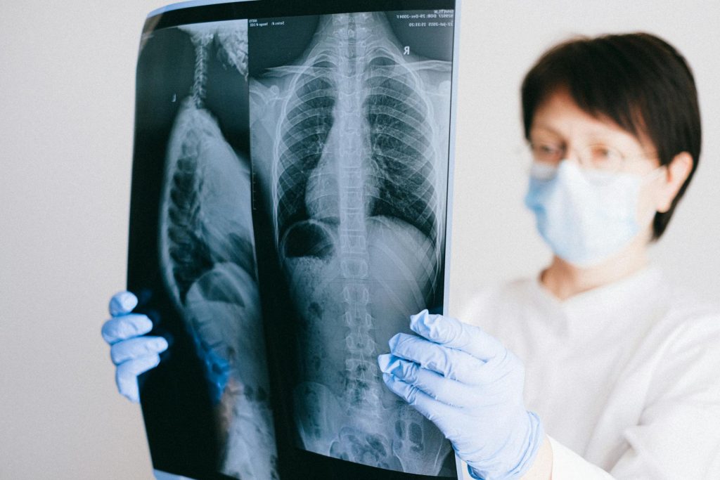 X-Ray – Durham Radiology